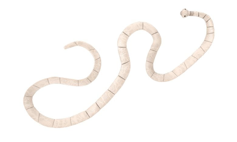 Estas son las señales de que puedes tener un parásito intestinal