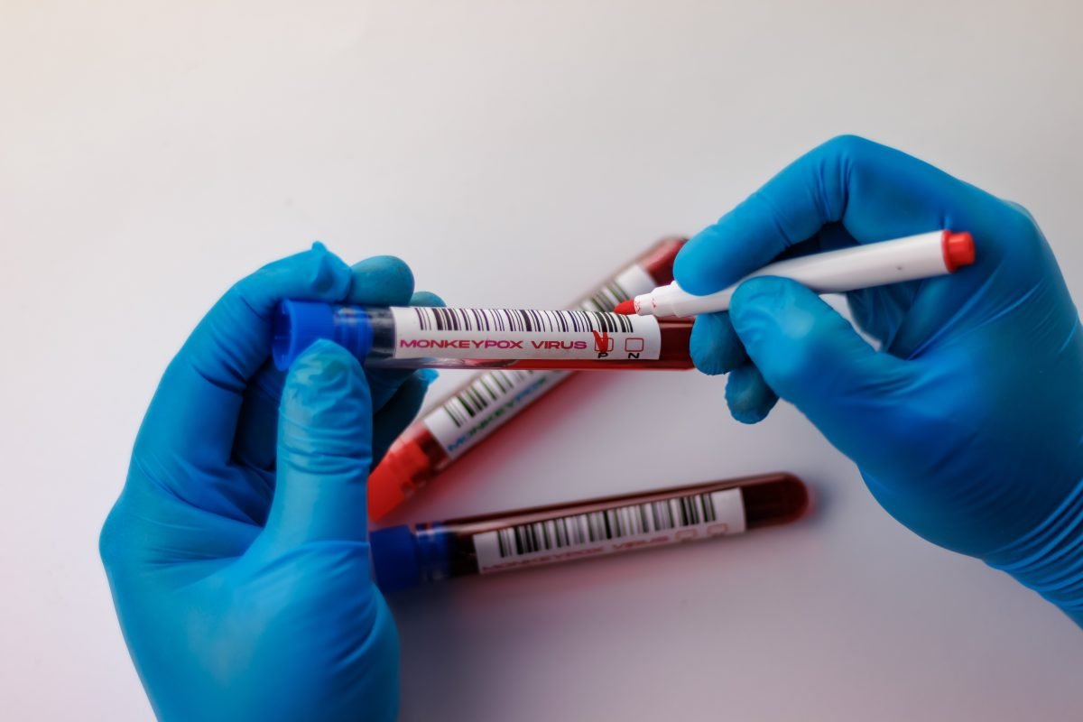 Análisis de sangre que se deben realizar con regularidad para vigilar ...