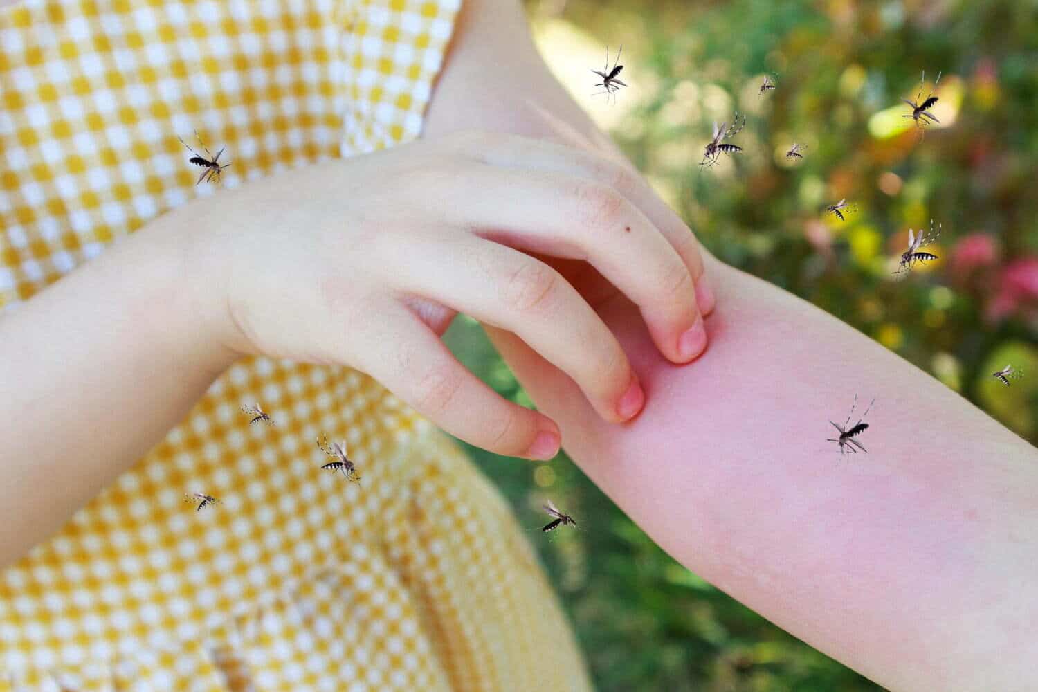 ¿Por qué los mosquitos sólo pican a unas pocas personas?