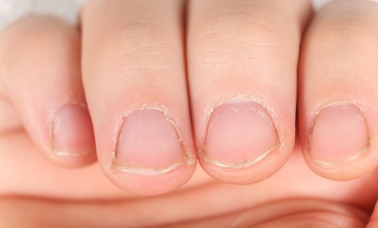 Las 6 razones por las que tus uñas son feas, quebradizas y no crecen rápido