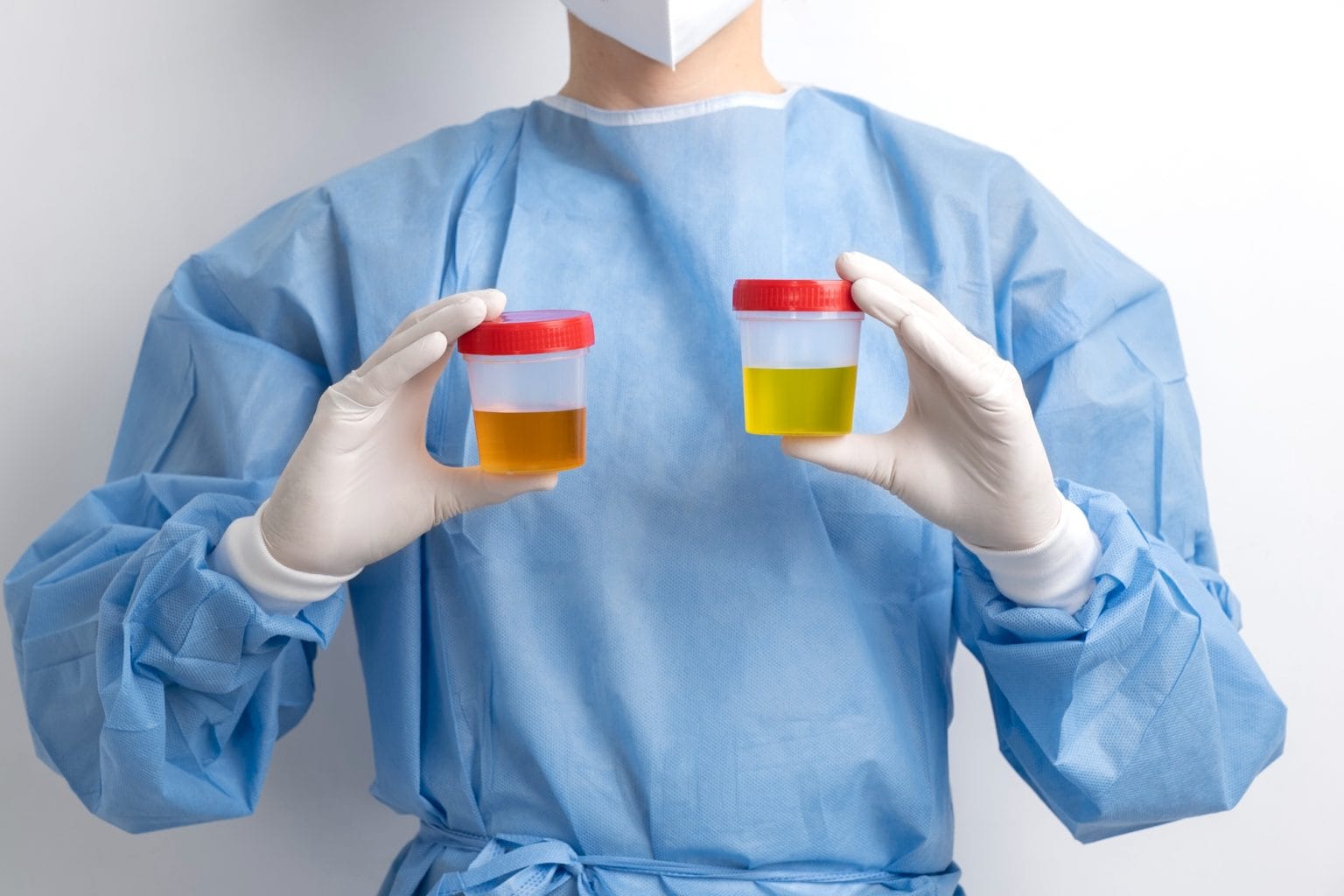 7 cosas importantes que el color de tu orina dice sobre tu salud